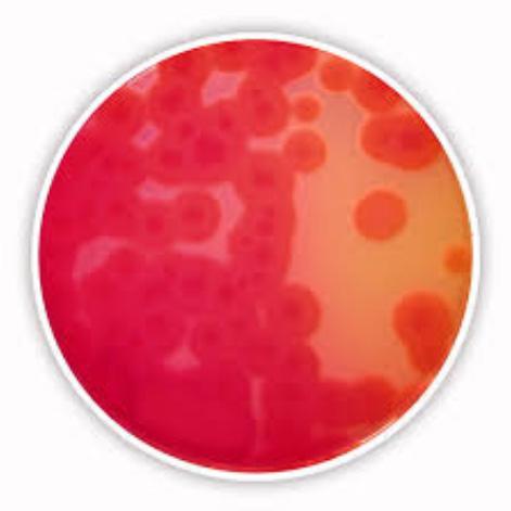 Bacillus cereus agar (MYP) - 500 gram - Food Diagnostics